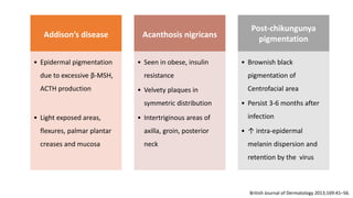Facial hypermelanosis | PPTX