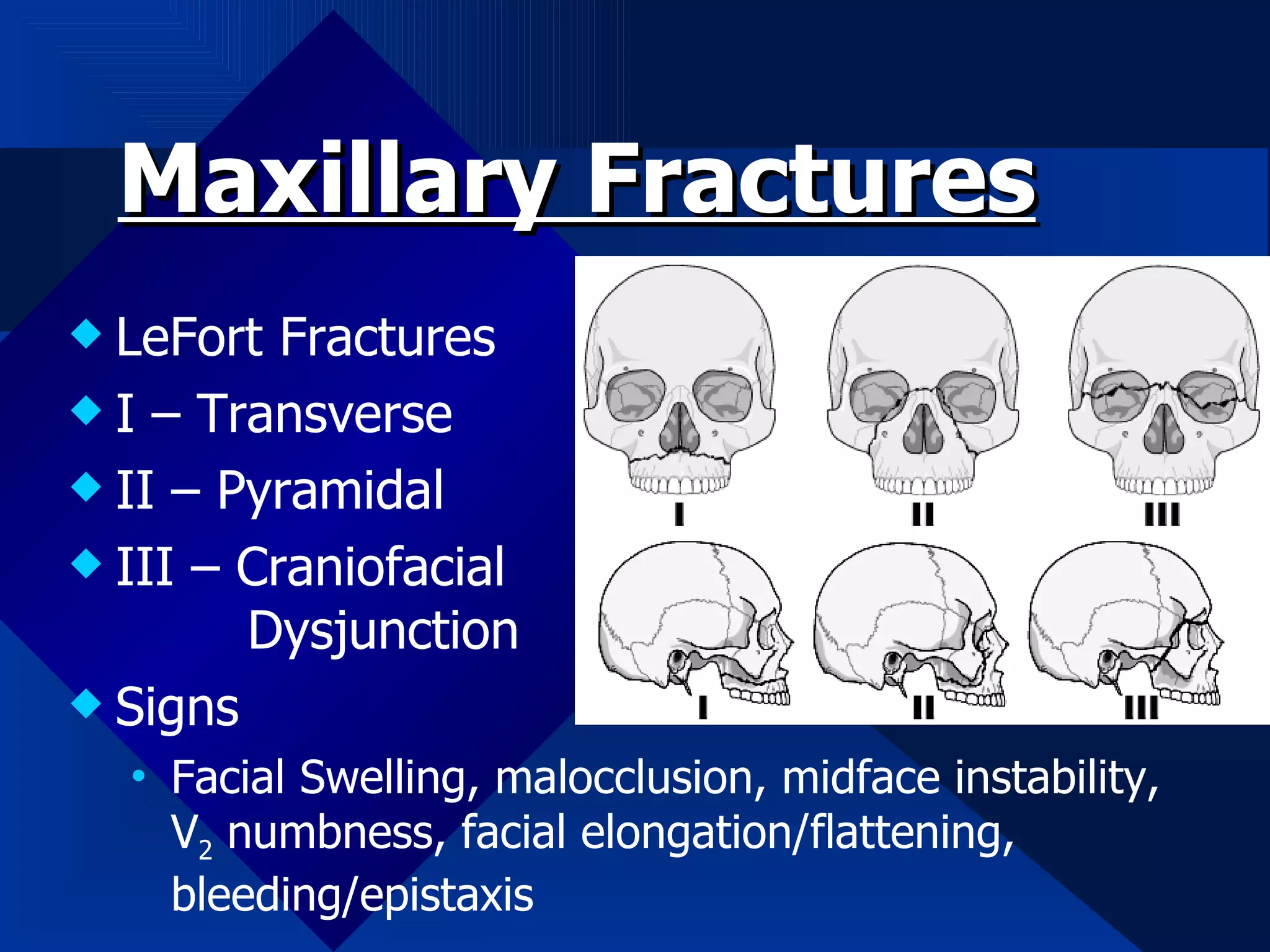 Types of Facial Injuries and Their indications for referrals | PPT