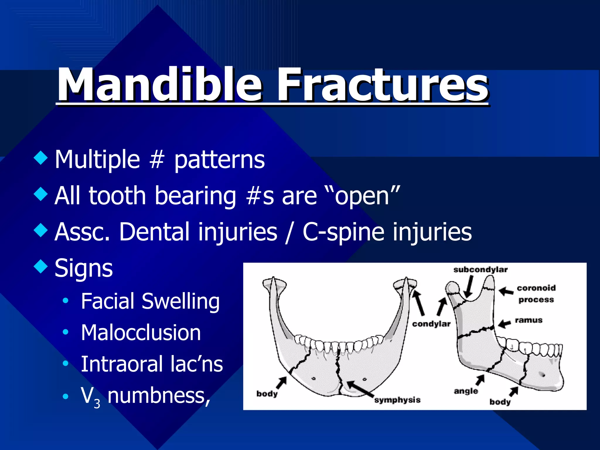 Types of Facial Injuries and Their indications for referrals | PPT