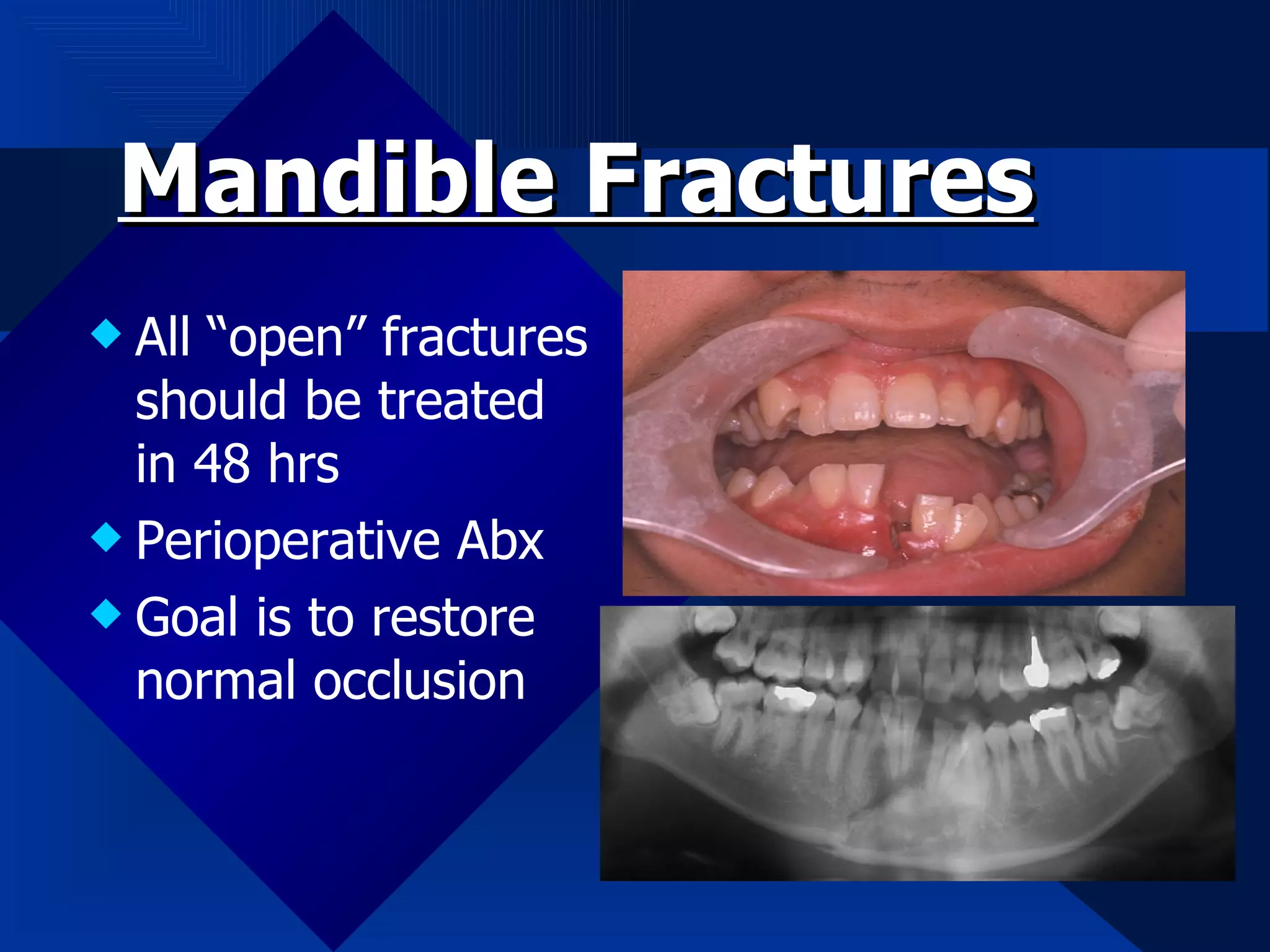 Types of Facial Injuries and Their indications for referrals | PPT