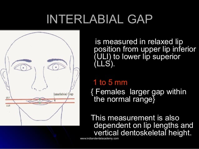 Facial keys to orthodontic diagnosis and treatment planning