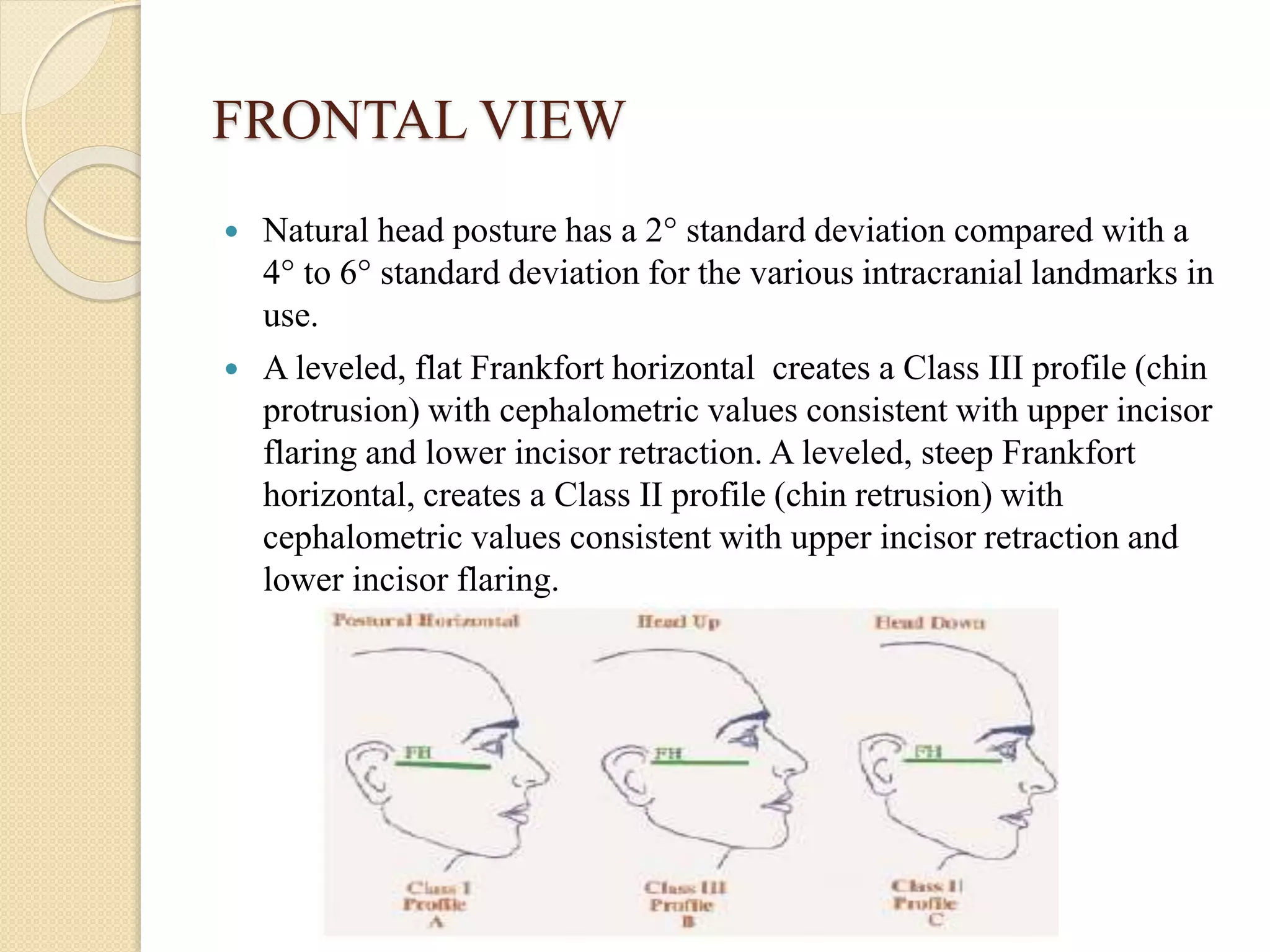 facial keys to ortho JC | PPTX