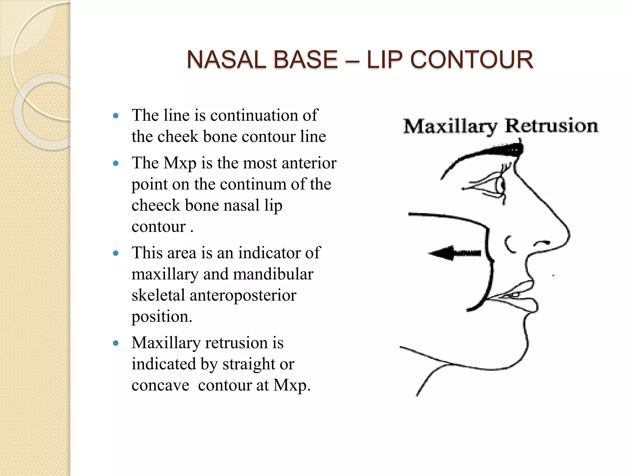 facial keys to ortho JC | PPTX