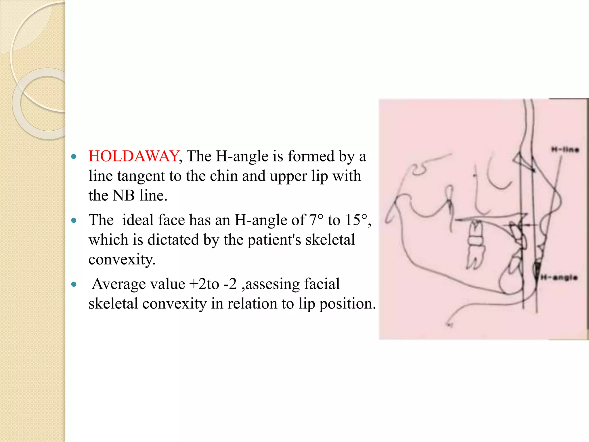 facial keys to ortho JC | PPTX