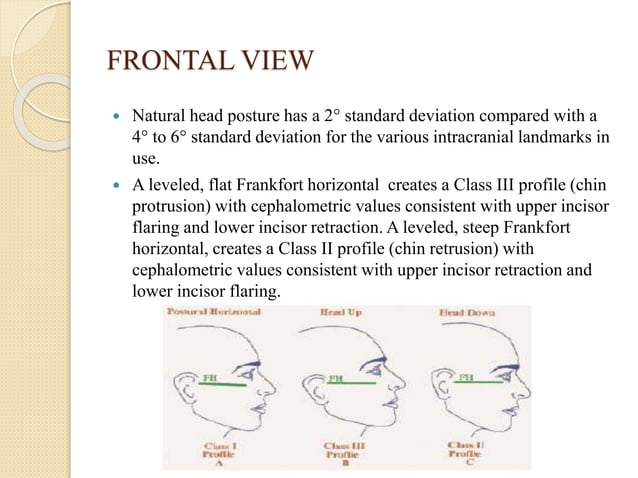 facial keys to ortho JC | PPTX