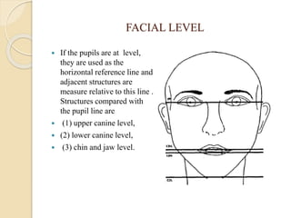 facial keys to ortho JC | PPTX
