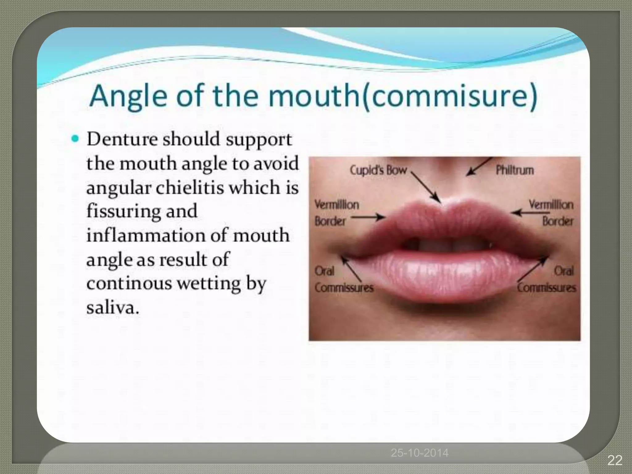 Facial landmarks & its role in prosthodontics | PPTX