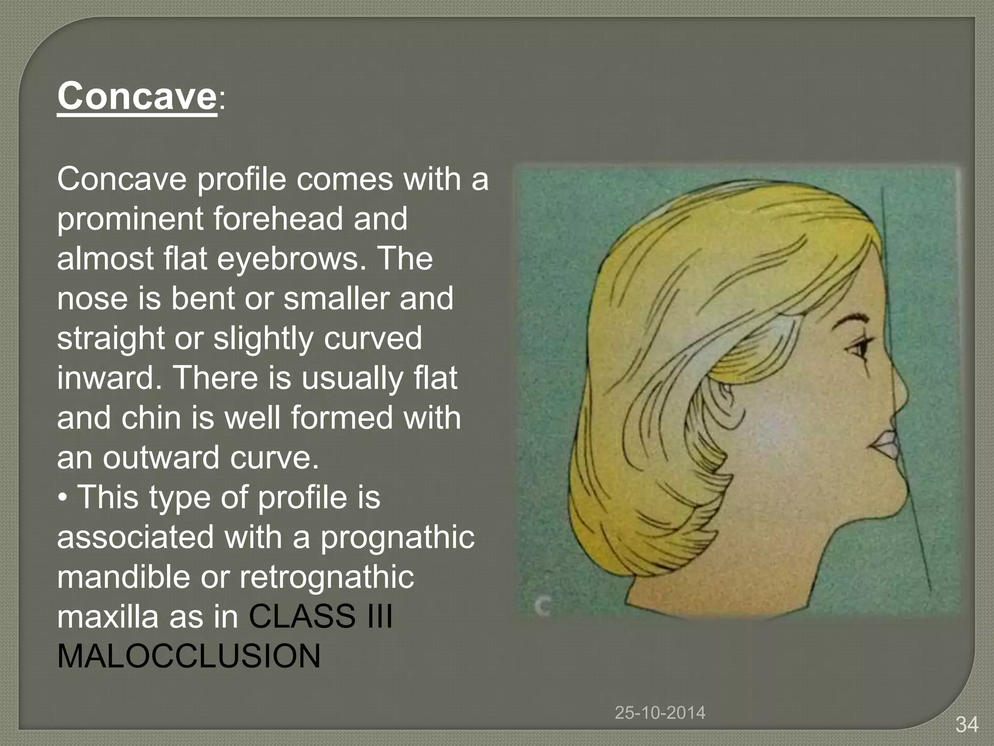 Facial landmarks & its role in prosthodontics | PPTX
