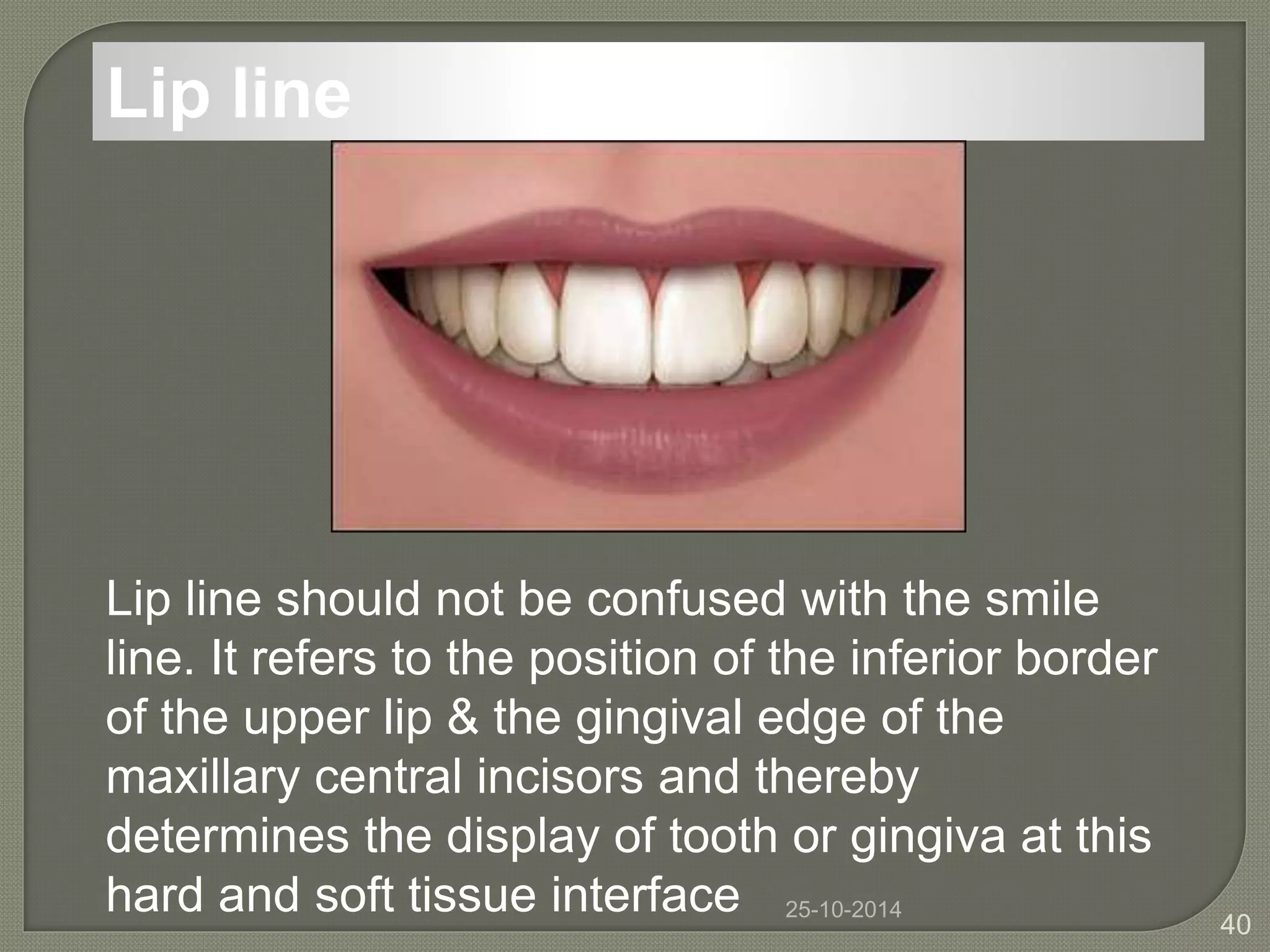 Facial landmarks & its role in prosthodontics | PPTX