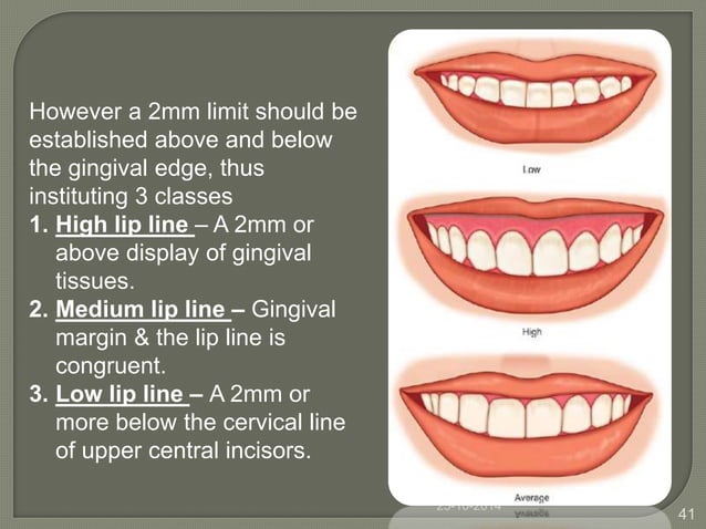 Facial landmarks & its role in prosthodontics | PPTX | Ear, Nose and ...
