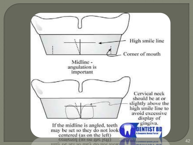 Facial landmarks & its role in prosthodontics | PPTX | Ear, Nose and ...