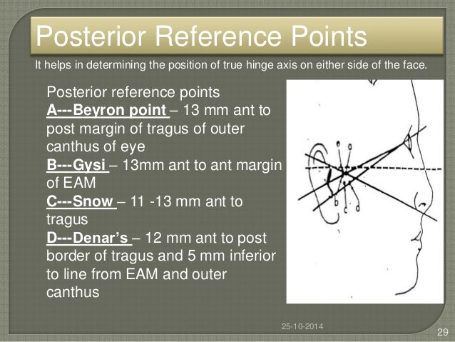 Facial landmarks & its role in prosthodontics