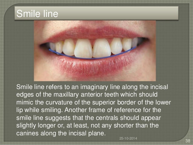 Facial landmarks & its role in prosthodontics