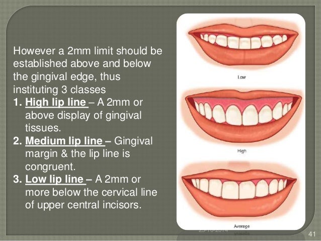 Facial landmarks & its role in prosthodontics
