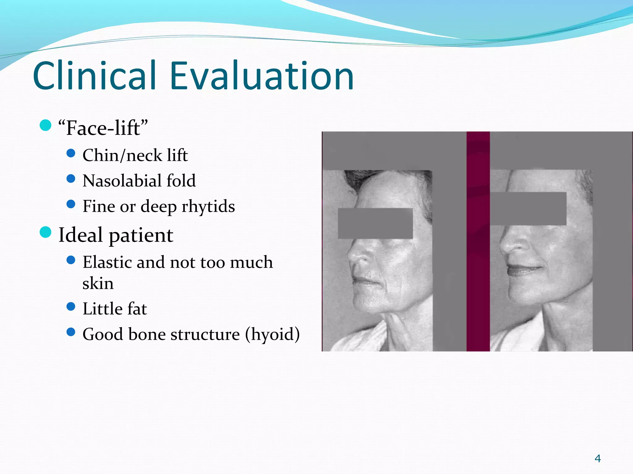 Facial lift | PPT