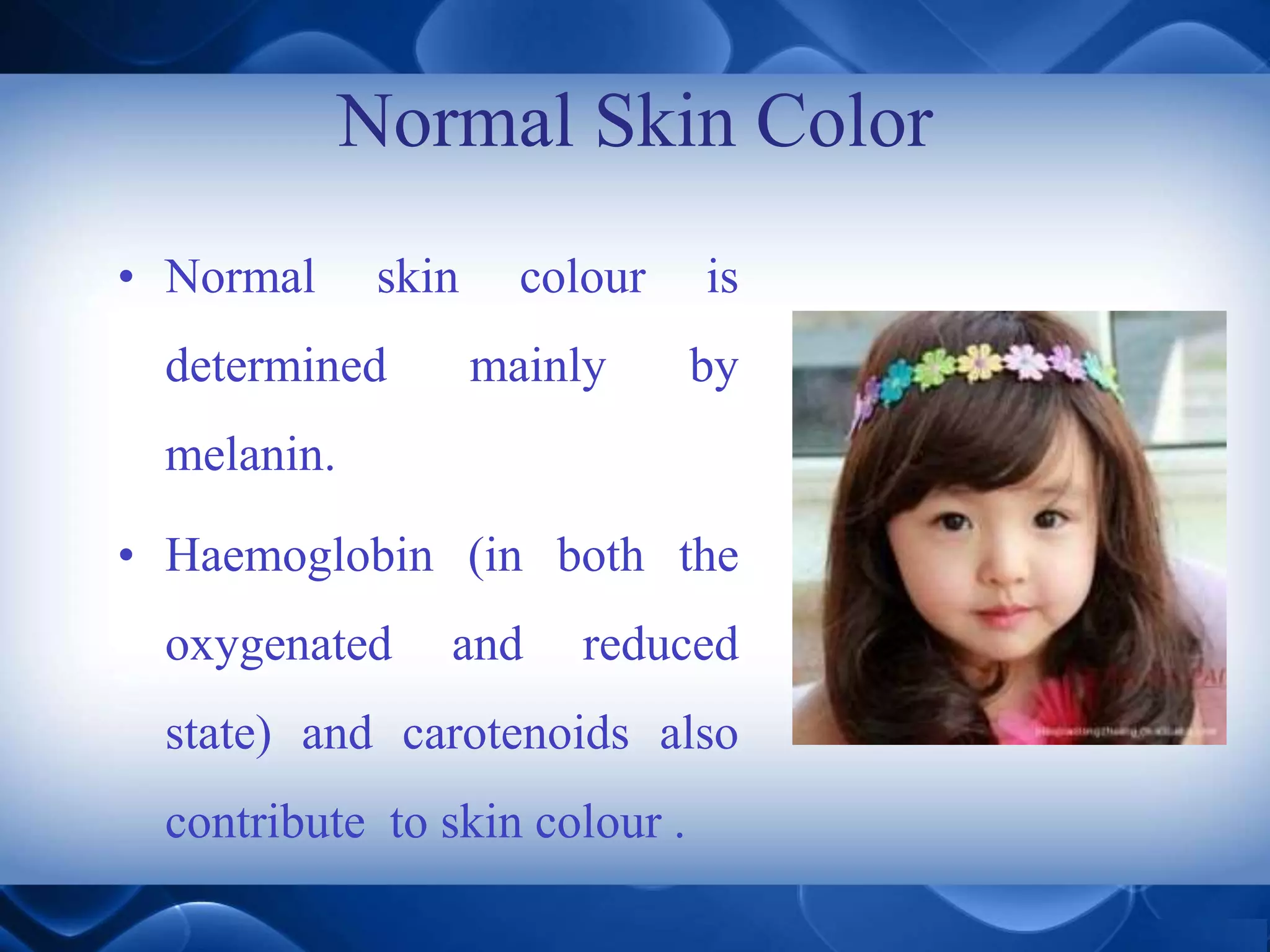 Facial melanoses | PPTX