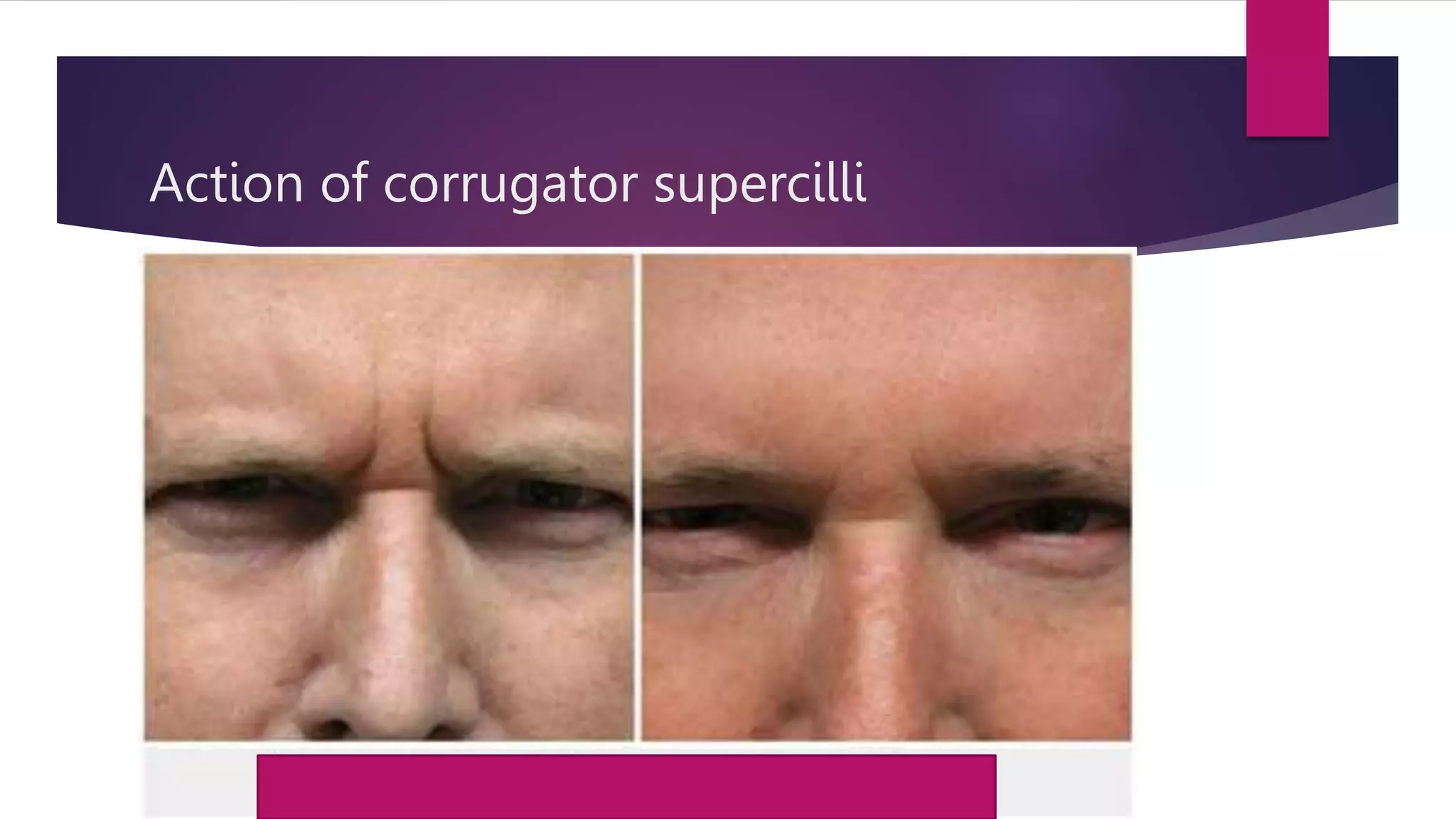 Facial muscles and its expression.pptx | Eye and Vision Conditions ...