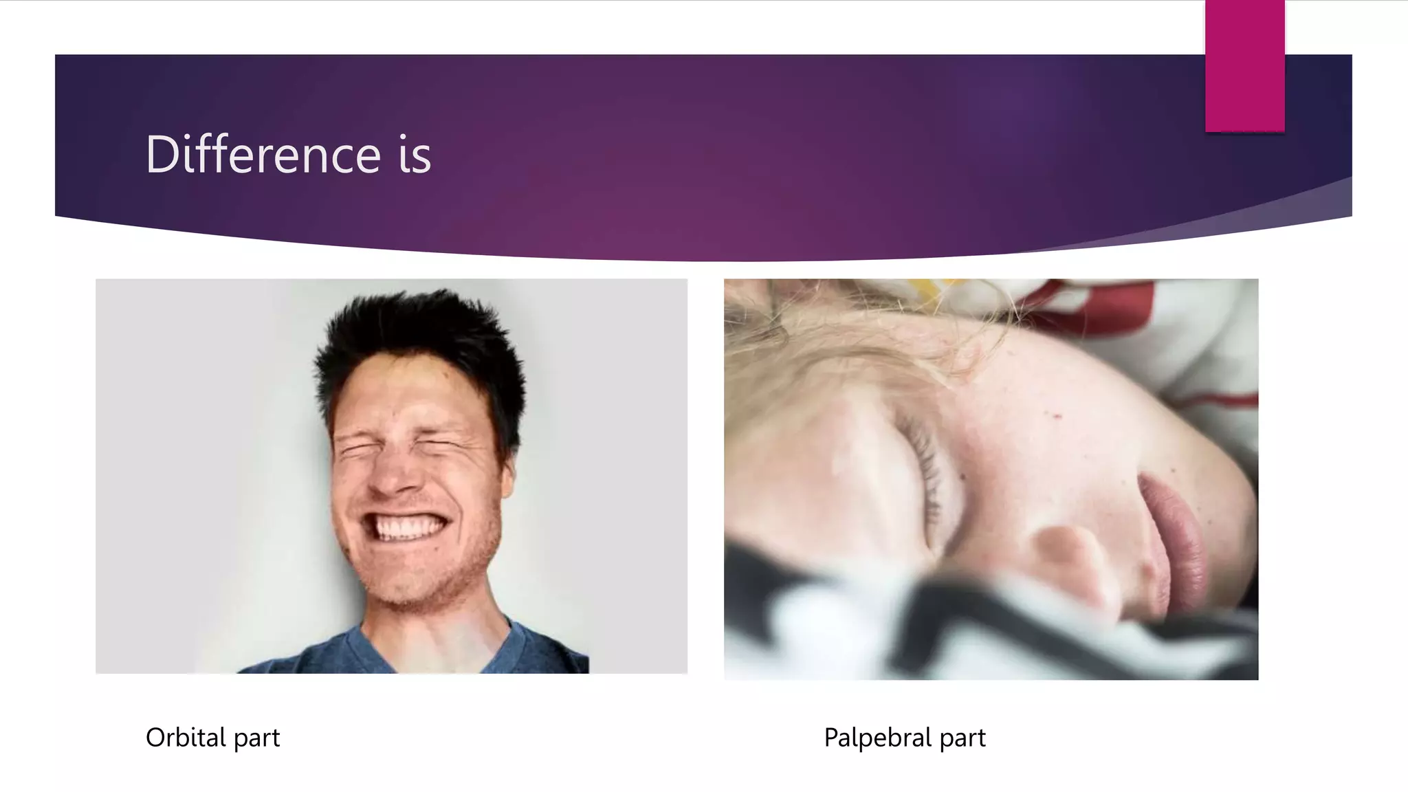 Facial muscles and its expression.pptx | Eye and Vision Conditions ...