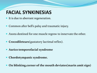 Facial nerve | PPTX