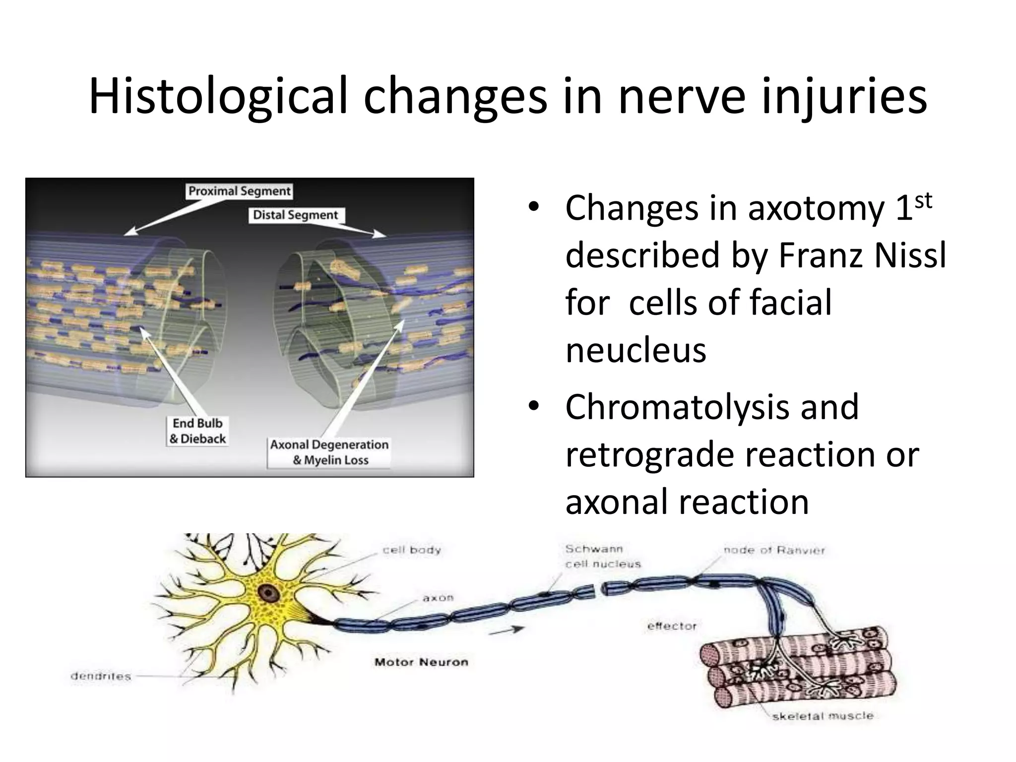 Facial nerve traumatic injury and repair | PPTX