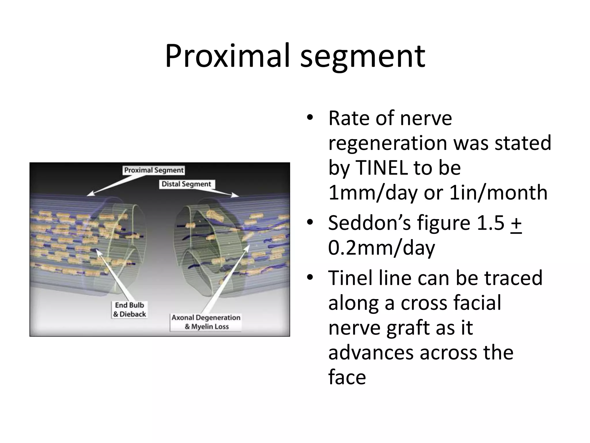 Facial nerve traumatic injury and repair | PPTX