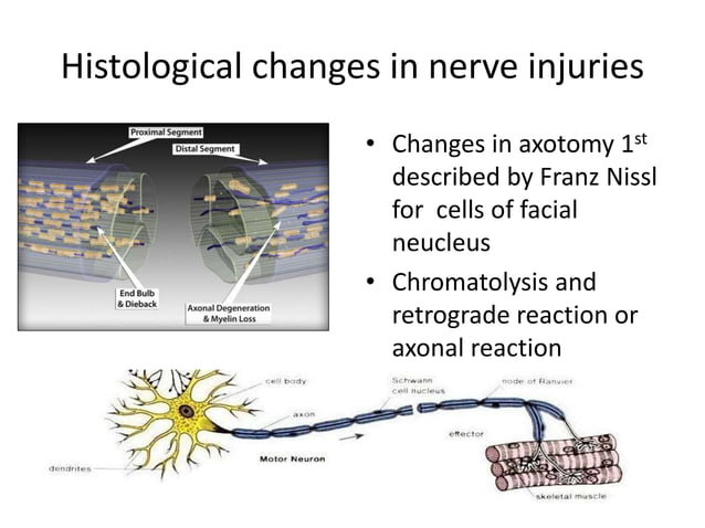 Facial nerve traumatic injury and repair | PPTX | Death, Injury, or ...