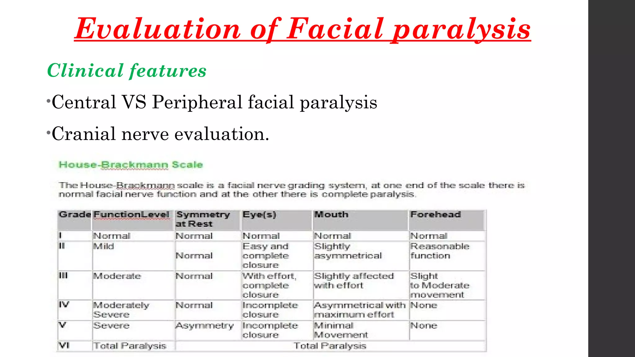 Facial Nerve Paralysis | PPT