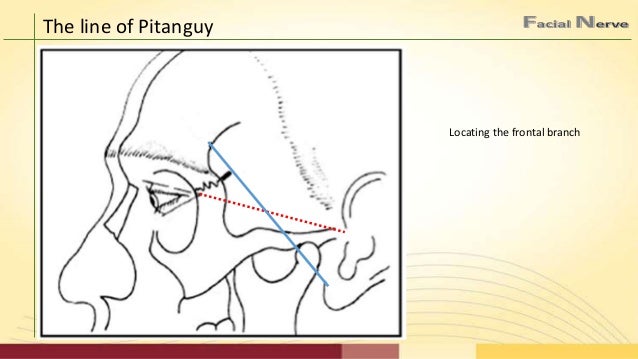 Facial nerve