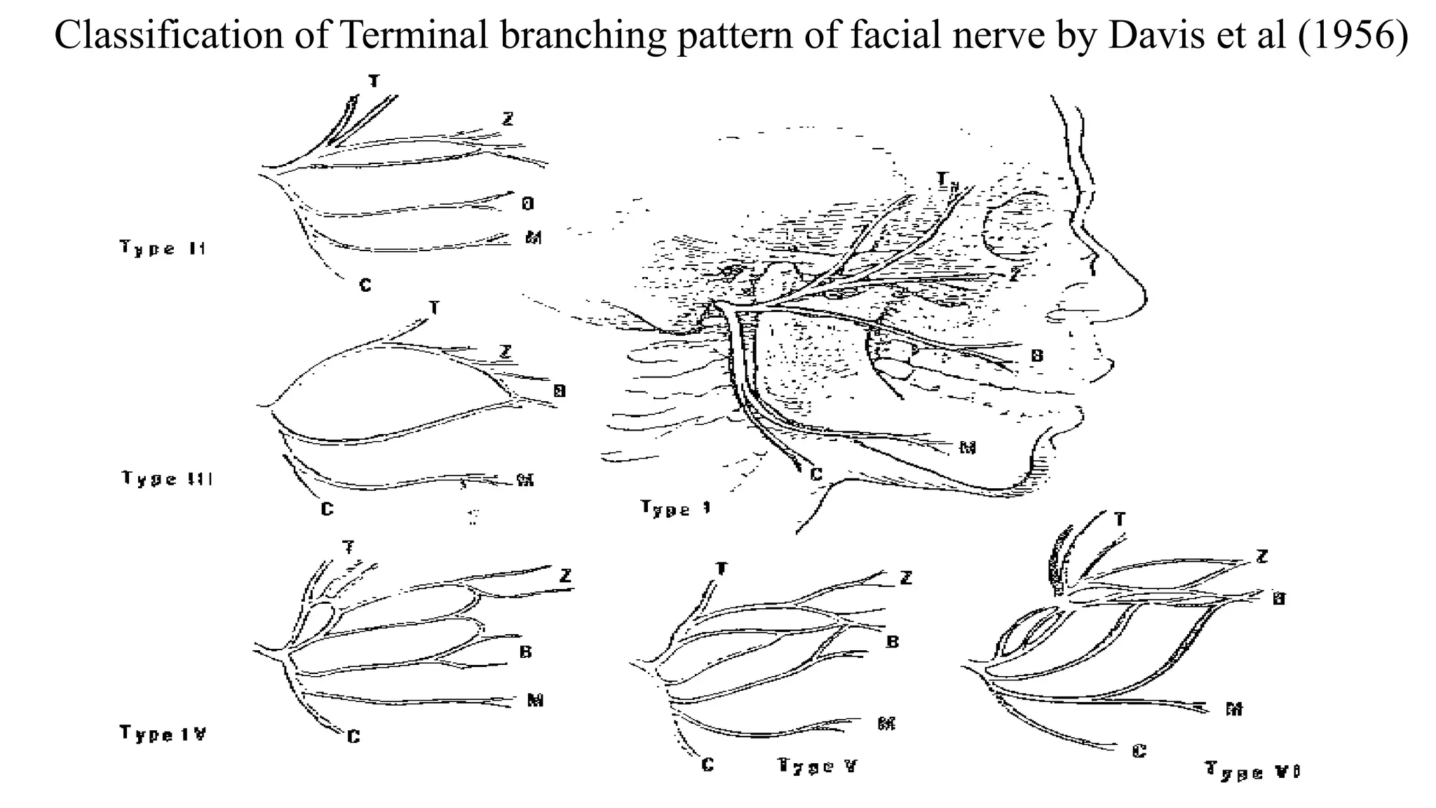 Facial nerve | PPTX