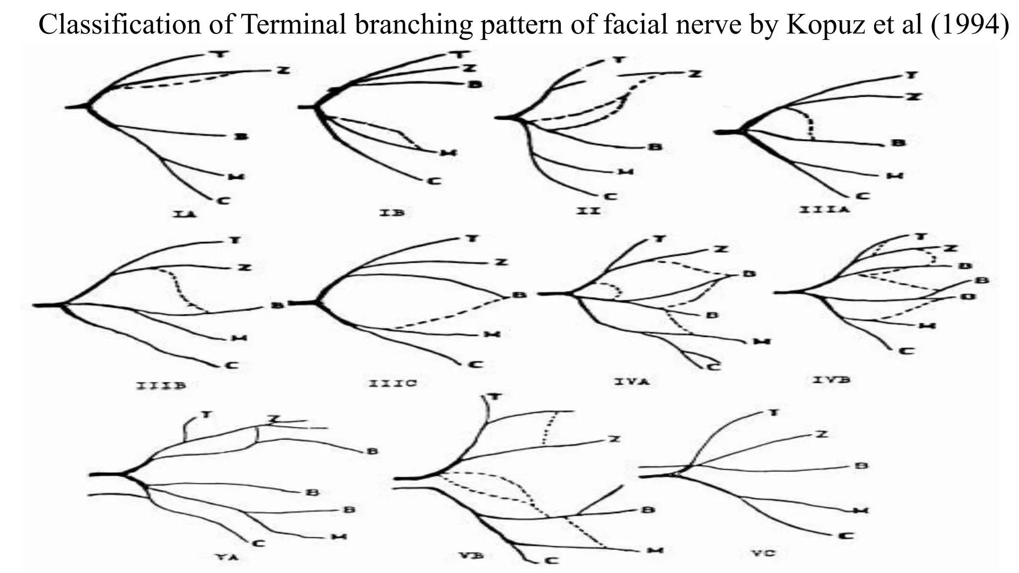 Facial nerve | PPTX