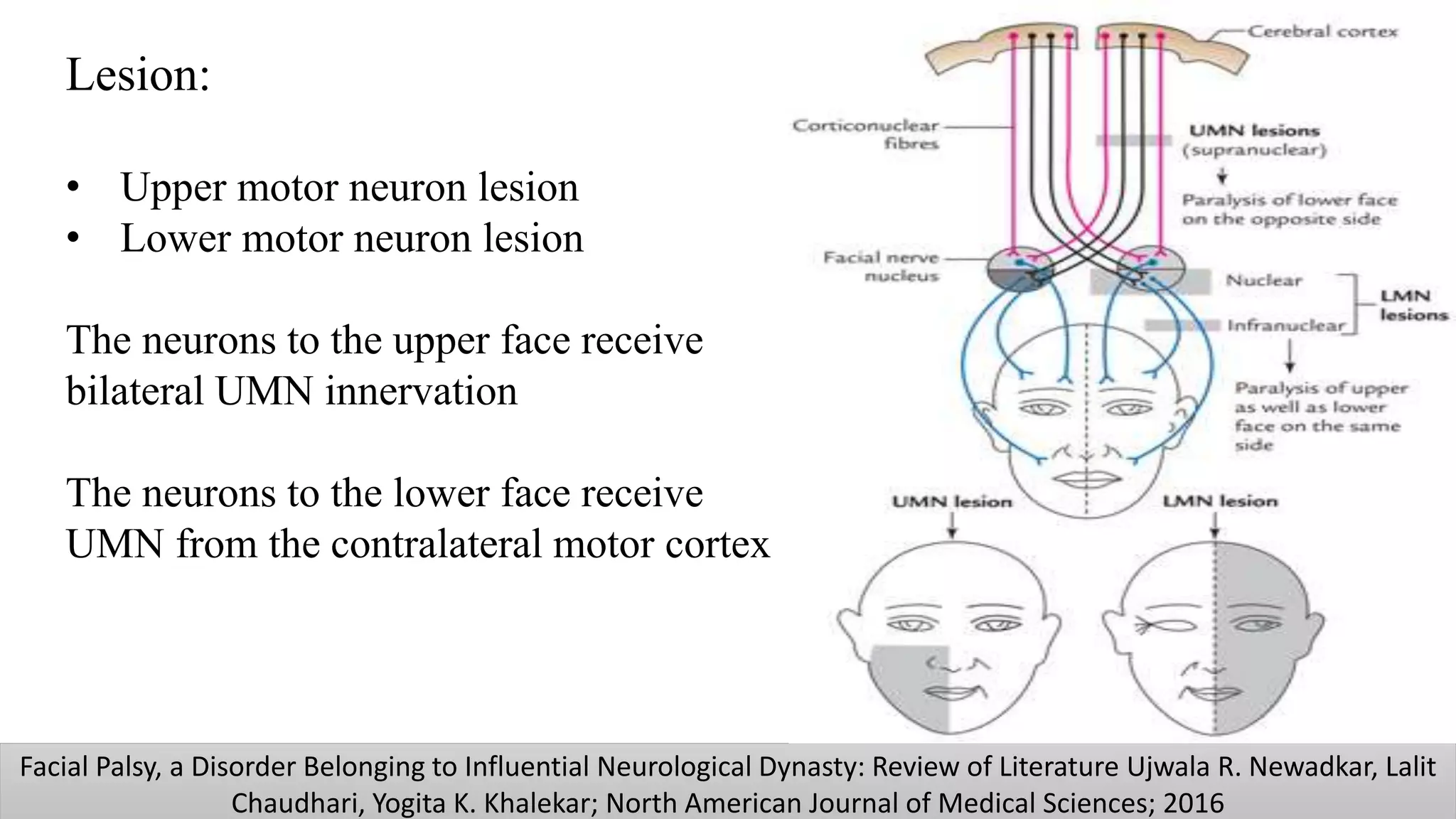 Facial nerve | PPTX