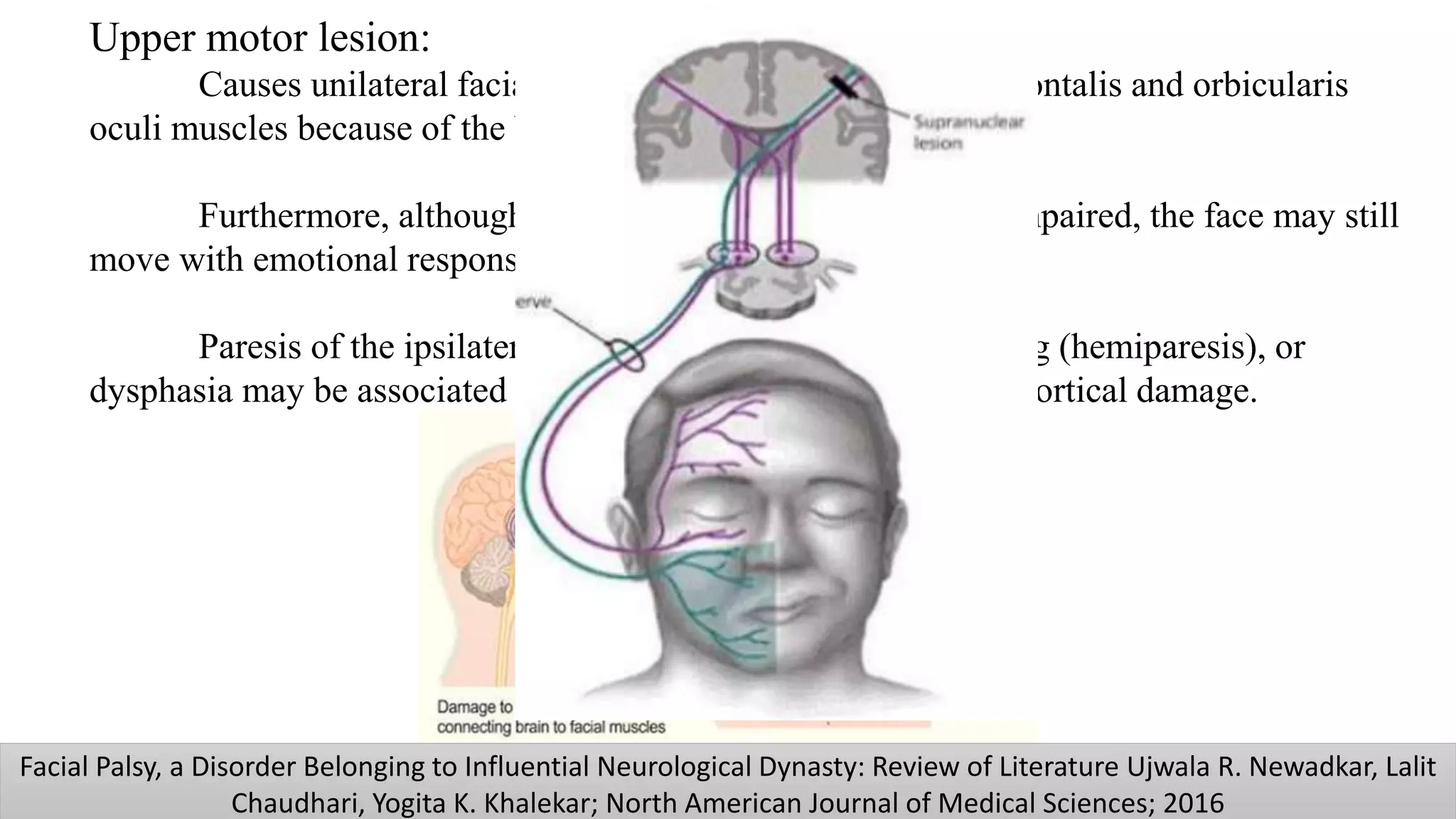 Facial nerve | PPTX