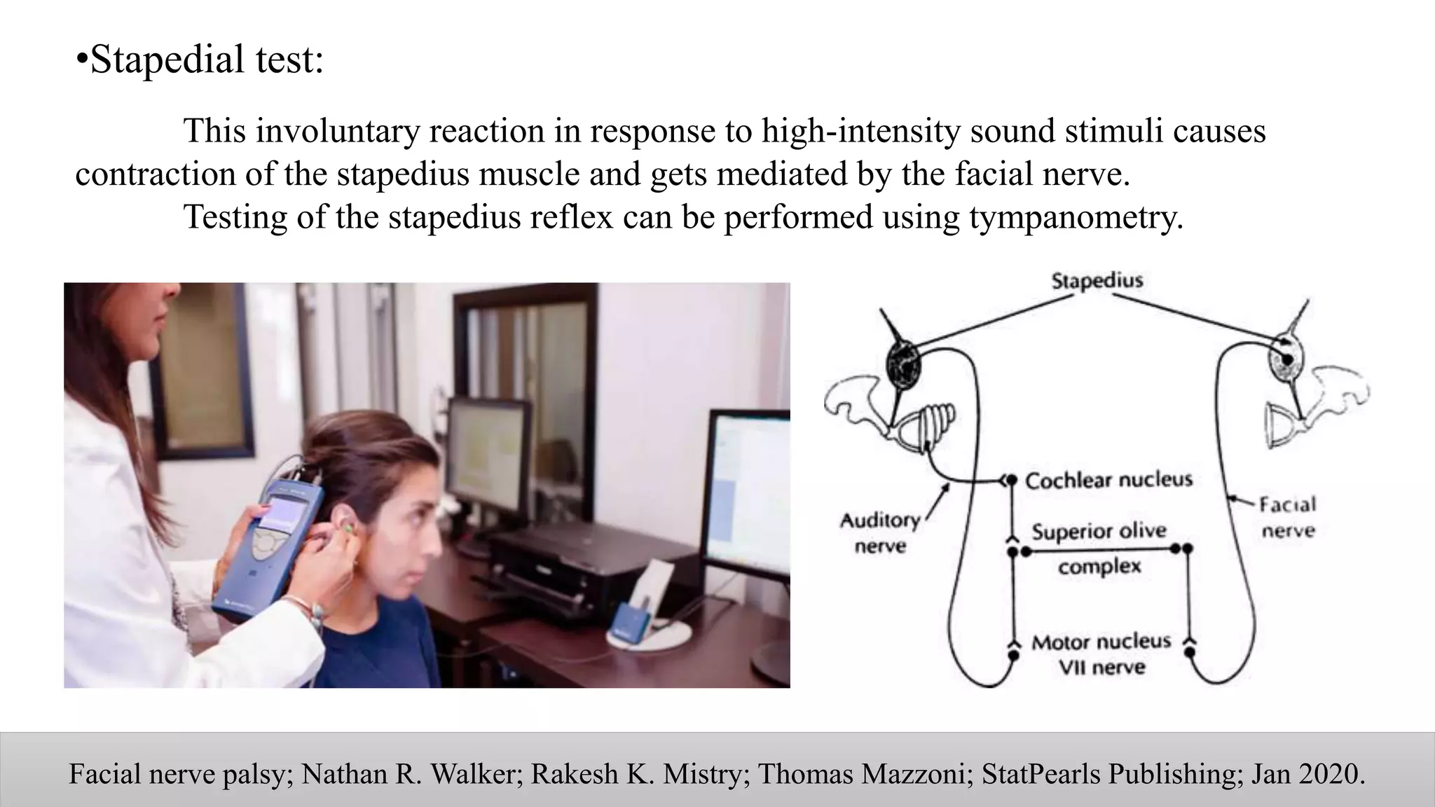Facial nerve | PPTX