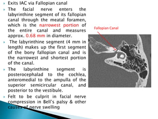 Facial nerve | PPT