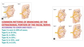 Facial nerve | PPTX