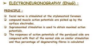 FACIAL NERVE.pdf