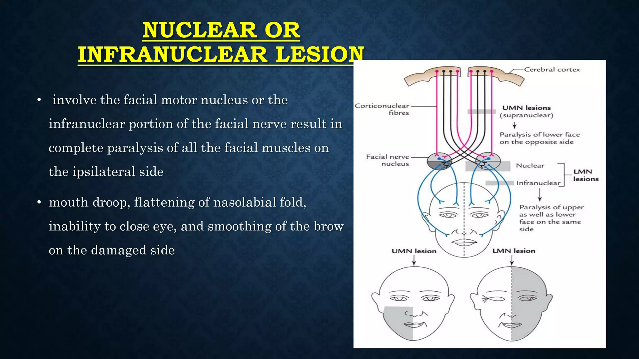 Facial Nerve.pptx