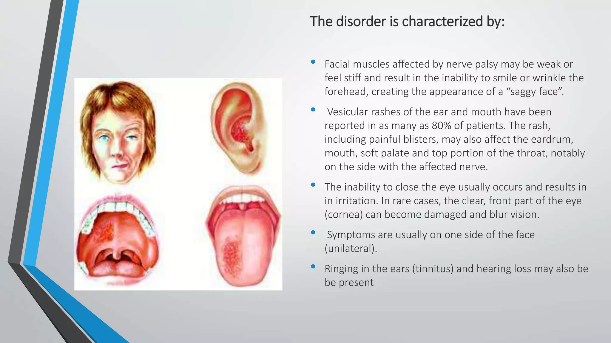 FACIAL NERVE.pptx