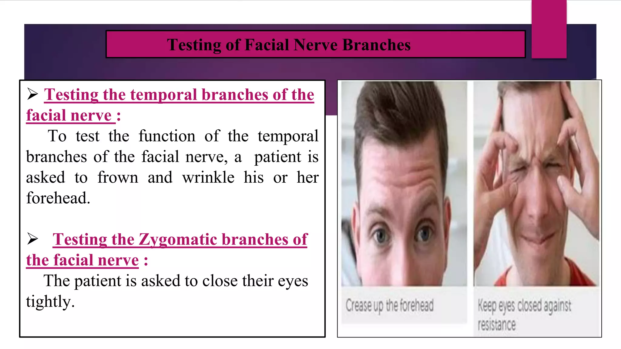 FACIAL NERVE.pptx