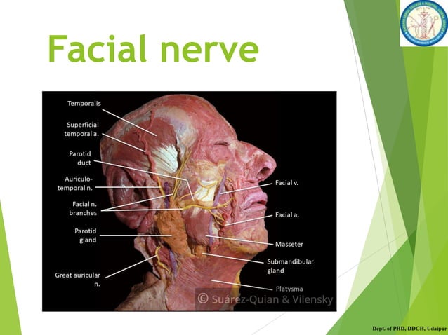 FACIAL NERVE its course and applied anatomy | PPTX | Ear, Nose and ...