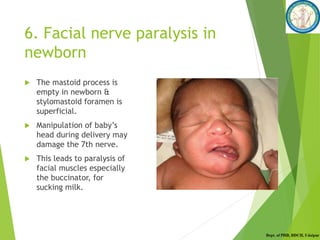 FACIAL NERVE its course and applied anatomy | PPTX