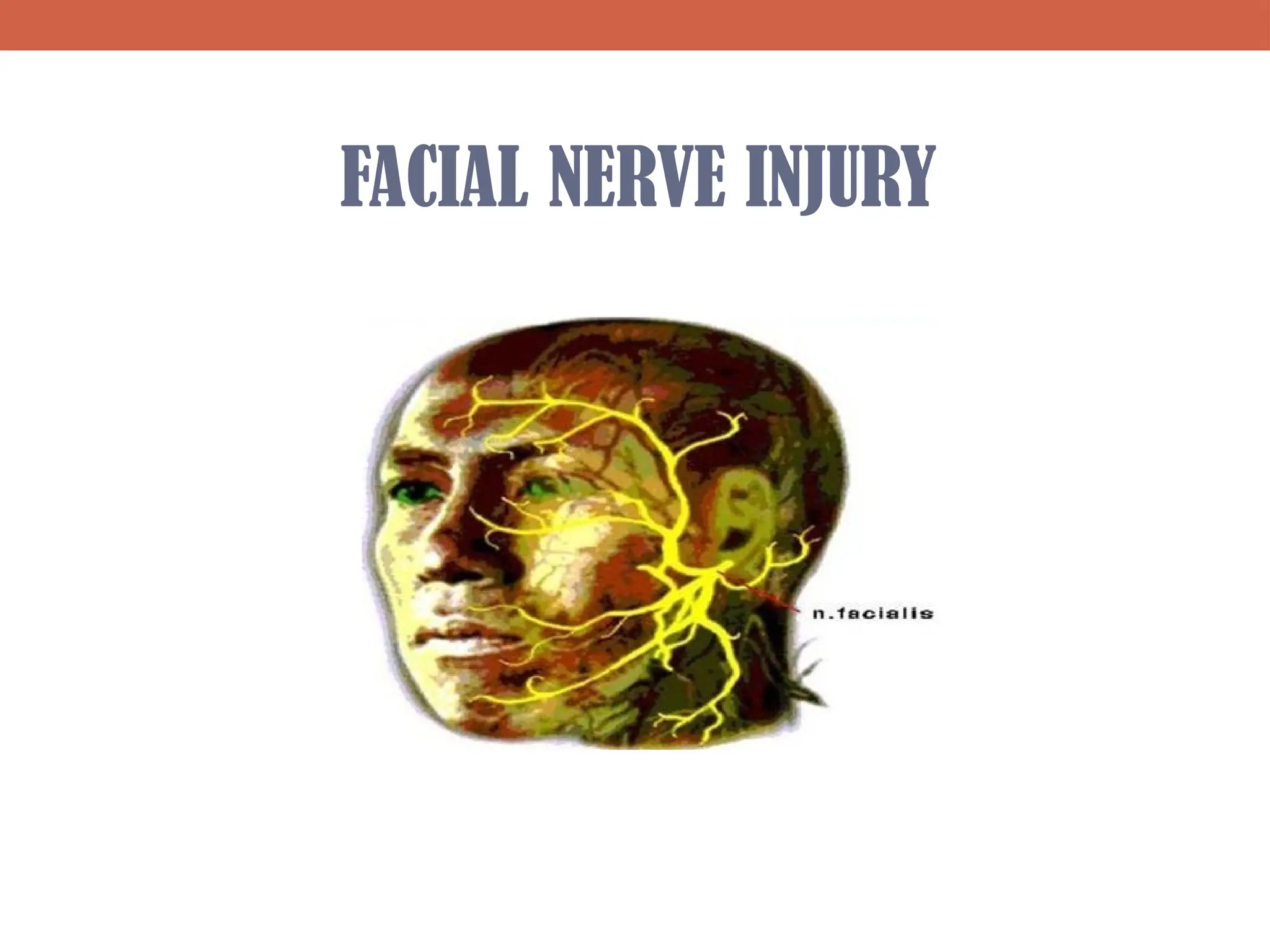 Facial Nerve Injury,Facial Nerve Injury,Facial Nerve Injury | PPTX ...