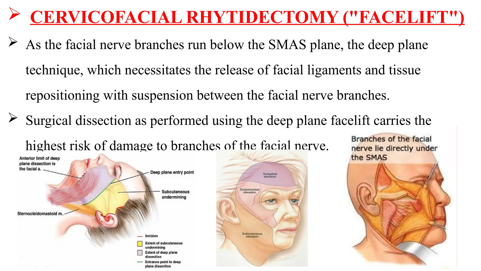 FACIAL NERVE ANATOMY AND ITS BRANCHES .pptx