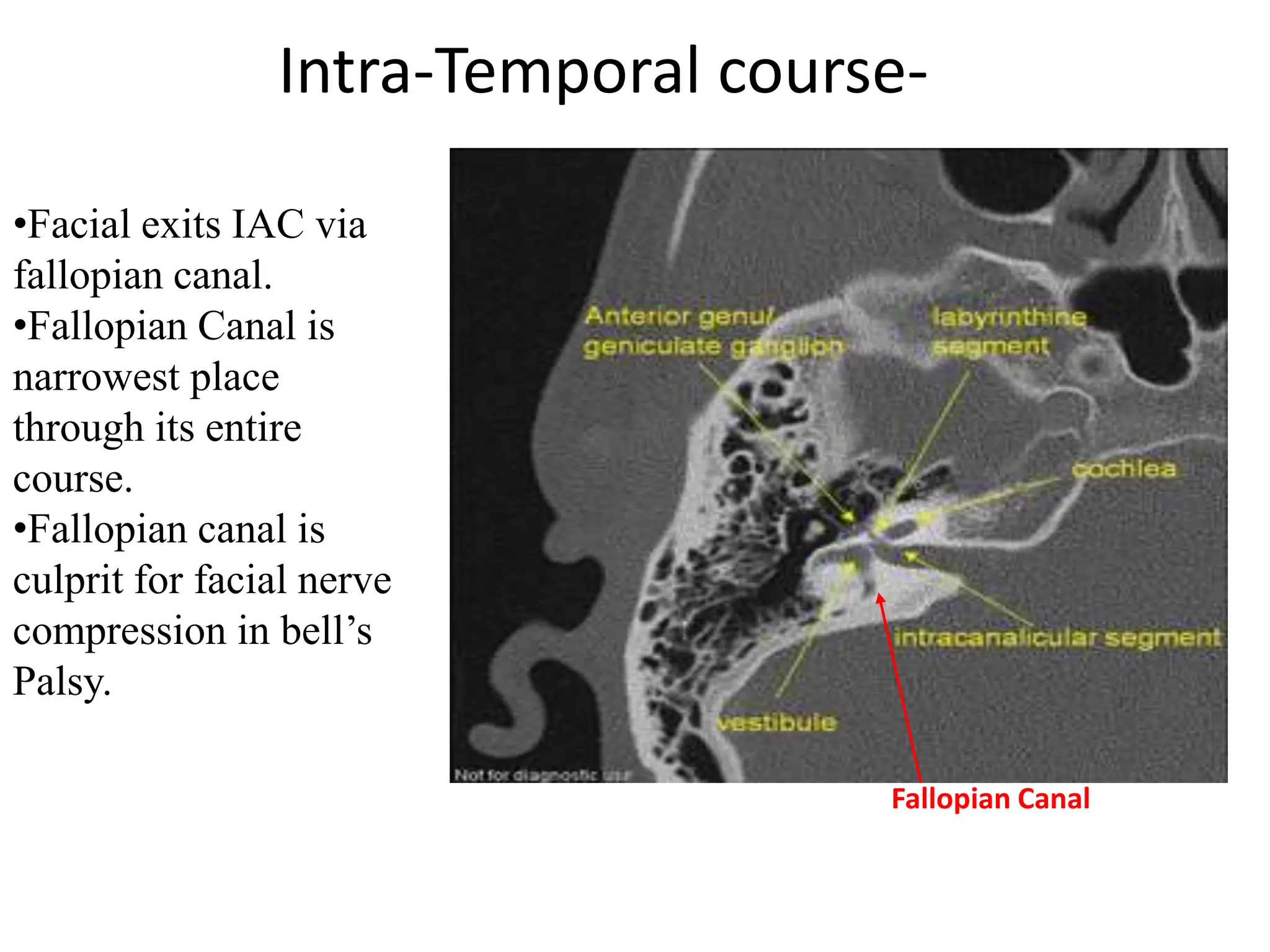 Facial nerve anatomy and important aspects | PPTX