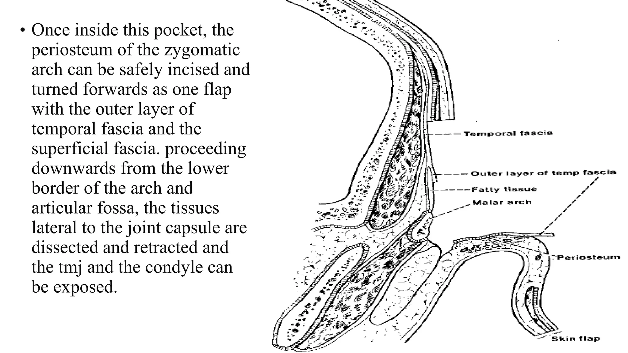 Facial nerve.pptx