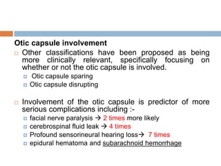 Facial nerve paralysis common causes | PPTX