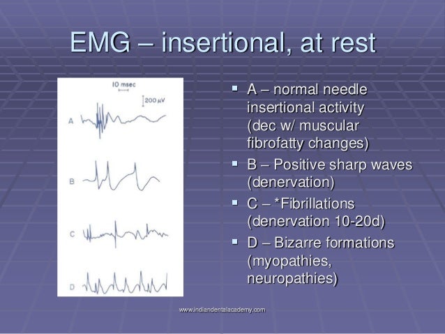 Facial nerve anatomy/certified fixed orthodontic courses by Indian de…