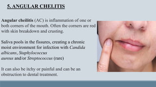 Facial nerve and it's applied aspect | PPTX