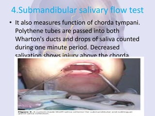 Facial nerve and its disorders | PPT