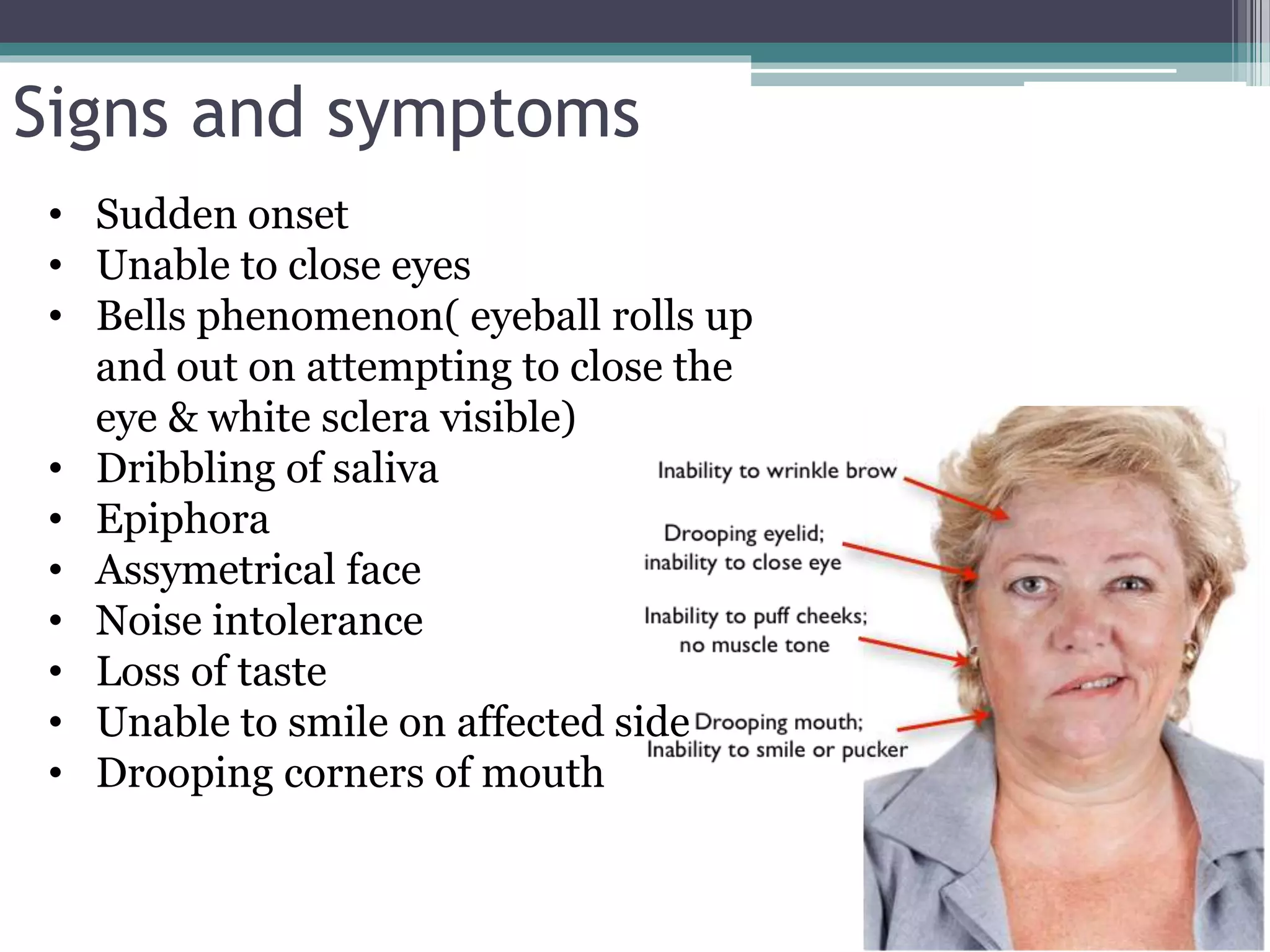Facial nerve and its disorders | PPTX
